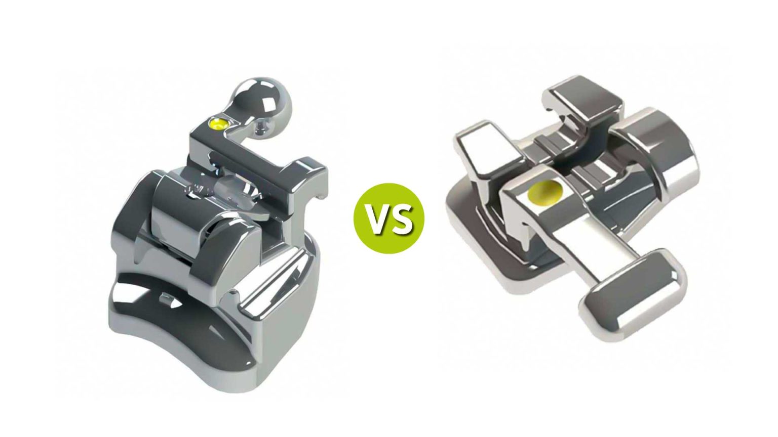 ¿Qué Colores de Cauchos para Tus Brackets Quieres Hoy? | Ortounión